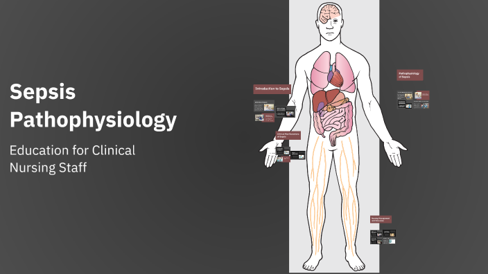 Sepsis Pathophysiology by Dalanie Fisher on Prezi