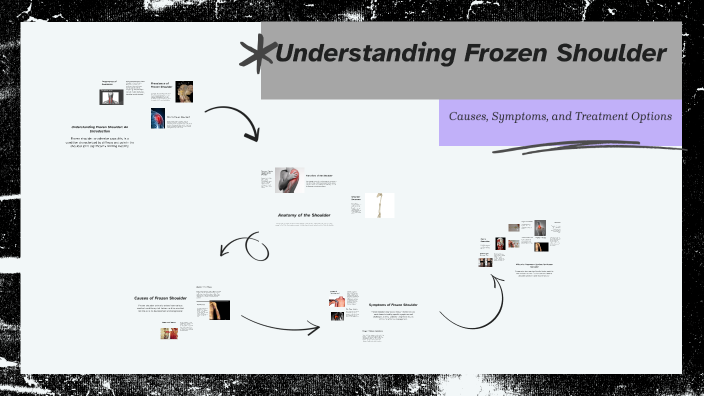 Understanding Frozen Shoulder by noa van der woude on Prezi