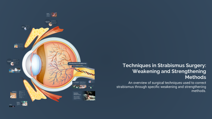 Techniques in Strabismus Surgery: Weakening and Strengthening Methods ...