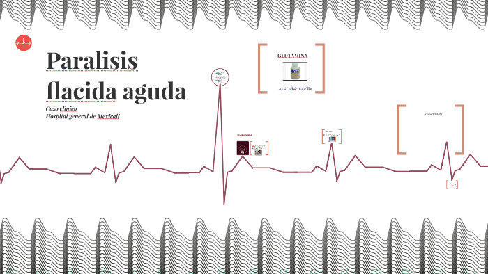 Paralisis flacida aguda by karla lopez on Prezi