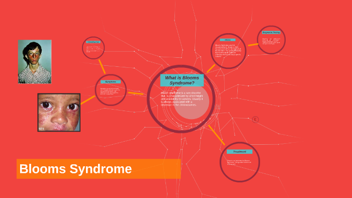 Blooms Syndrome by Joseph Flemings on Prezi