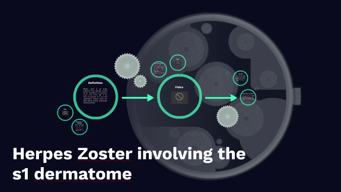 Herpes Zoster involving the s1 dermatome by Gustavo Nuñez on Prezi