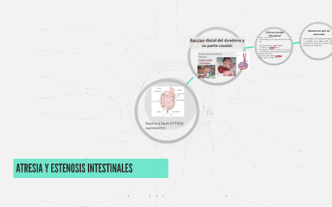ATRESIA Y ESTENOSIS INTESTINALES by Pamela Itúrburu on Prezi