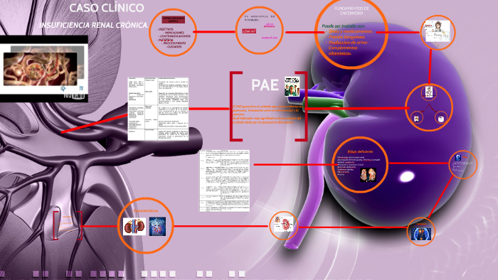 Caso ClÍnico Insuficiencia Renal By Lalo Rc On Prezi