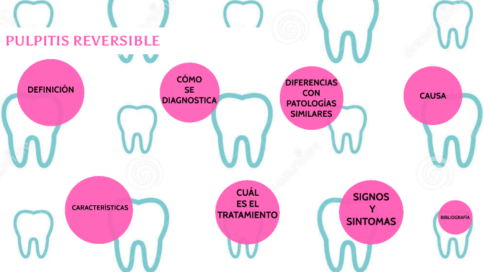 Pulpitis Reversible by Mier Flores Blanca on Prezi
