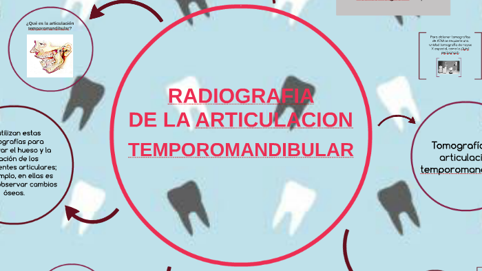 radiologia RX ATM by EA1 murillocamacho on Prezi