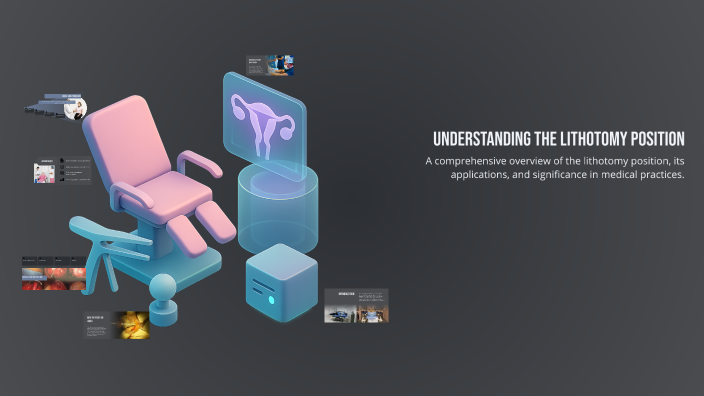 Understanding the Lithotomy Position by stalin. on Prezi