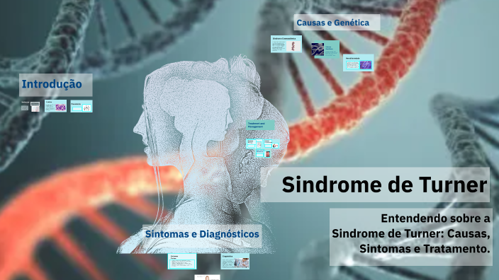 Sindrome de Turner by Caroline Malveira on Prezi