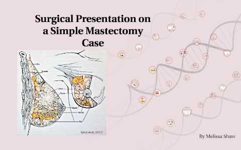 Surgical Presentation on a Simple Mastectomy Case by melissa shaw on Prezi