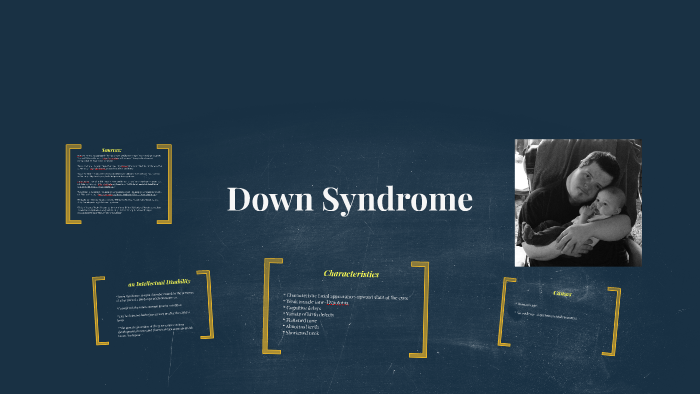 Down Syndrome by Jessica Nowell on Prezi