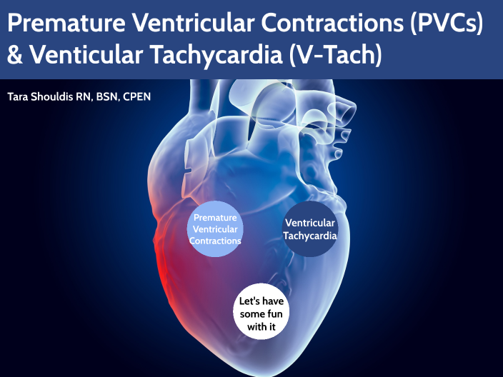 Ventricular Tachycardia and PVCs by Tara Shouldis on Prezi
