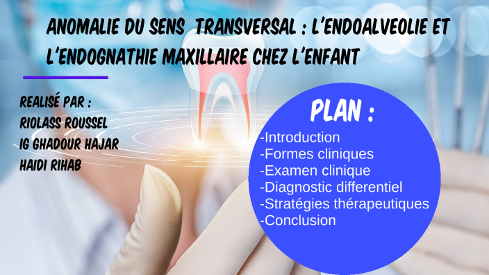 Anomalie du sens tranversal : Endoalvéolie et Endognathie du maxillaire ...