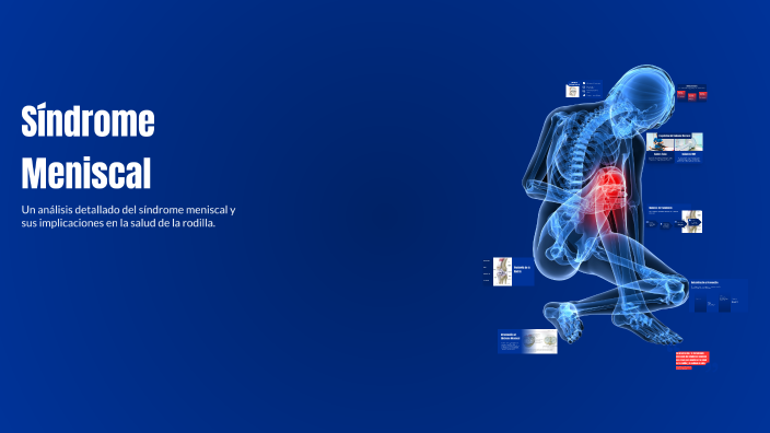 Síndrome Meniscal by Jesus Chavez guzman on Prezi