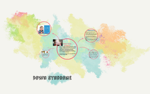 Down Syndrome by Sarah Rigney on Prezi