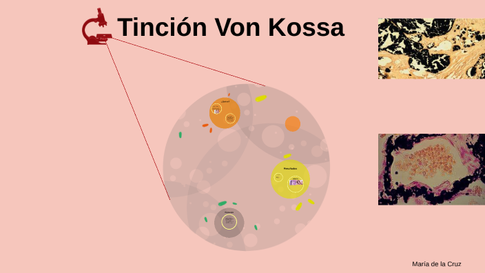 Tinción de Von Kossa by maria de la cruz on Prezi