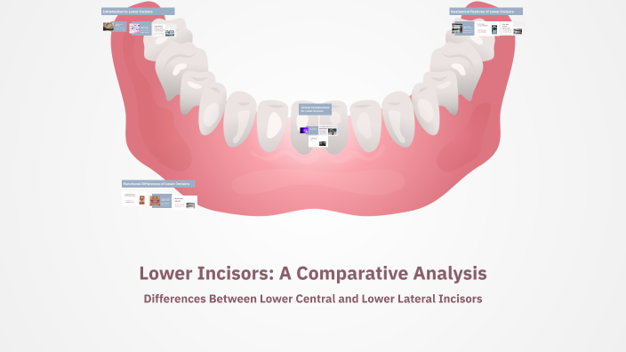 Lower Incisors: A Comparative Analysis by Omar Ayman on Prezi