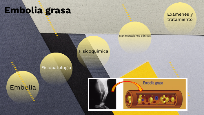 Embolia grasa by RICKY MARTINEZ on Prezi