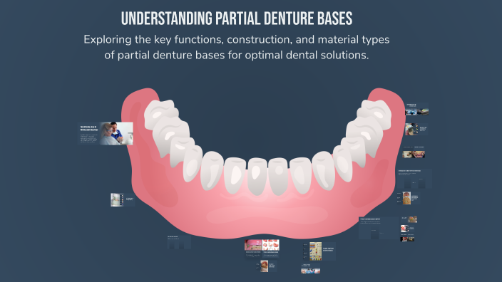 Understanding Partial Denture Bases by مدحت أحمد on Prezi