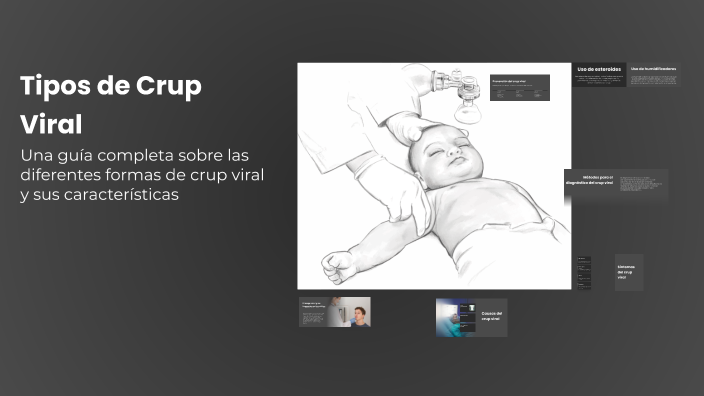 Tipos de Crup Viral by leo fg on Prezi