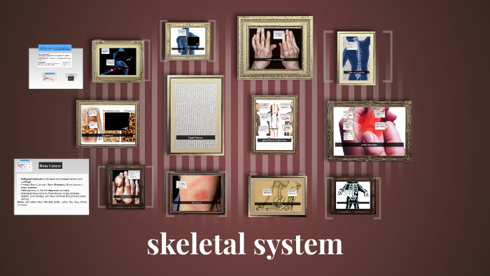 Skeletal Pathologies by erika dearen on Prezi