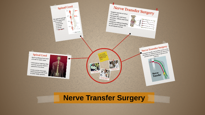 Nerve Transfer Surgery by Connie L on Prezi