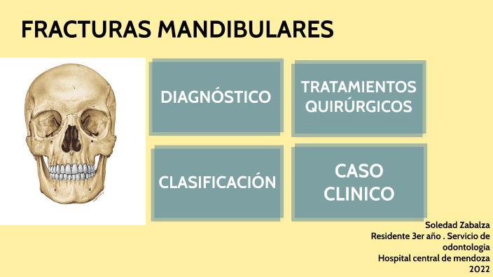 FRACTURAS MANDIBULARES by soledad maza