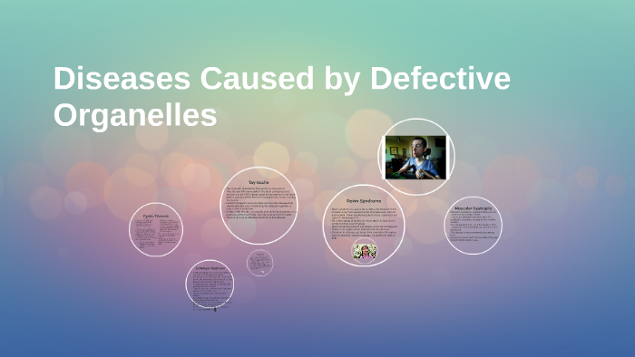 Diseases Caused by Defective Organelles by Cody Manion on Prezi