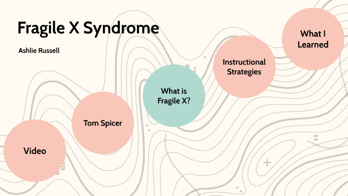 Fragile X Syndrome by Ashlie Russell on Prezi