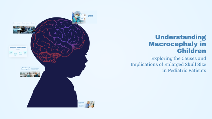 Understanding Macrocephaly in Children by Dffsy Etuf on Prezi