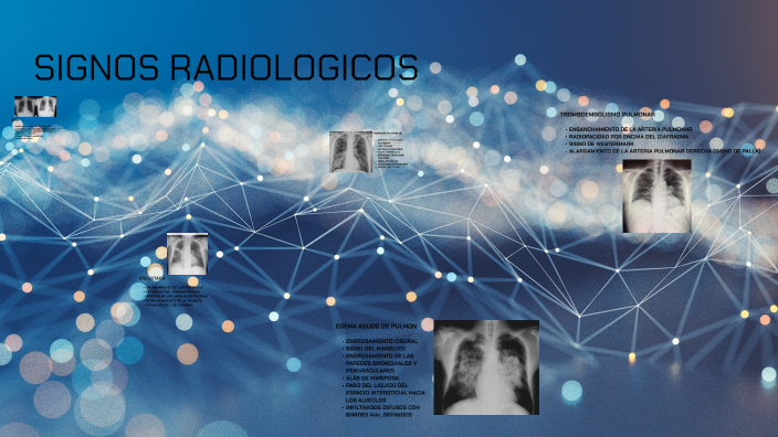 SIGNOS RADIOLOGICOS by MANUEL SANTIAGO MUÑOZ GIRALDO on Prezi