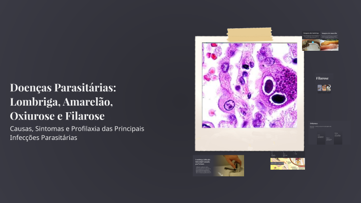 Doenças Parasitárias: Lombriga, Amarelão, Oxiurose e Filarose by ...