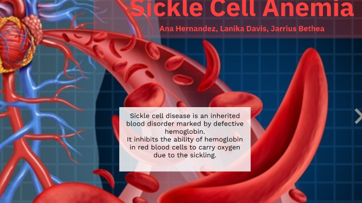 Sickle Cell Presentation by Jarrius Bethea on Prezi