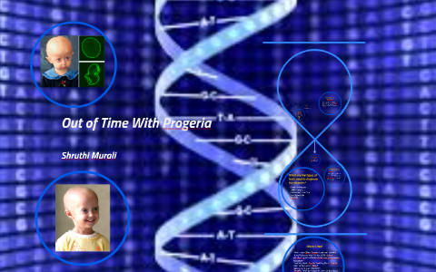 Out of Time With Progeria by SCIENCE SCIENCE` on Prezi