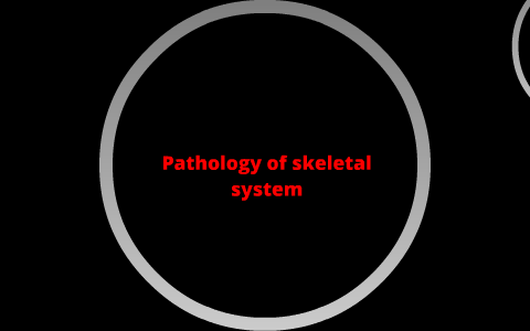 Pathology of skeletal system by kimberly andis on Prezi