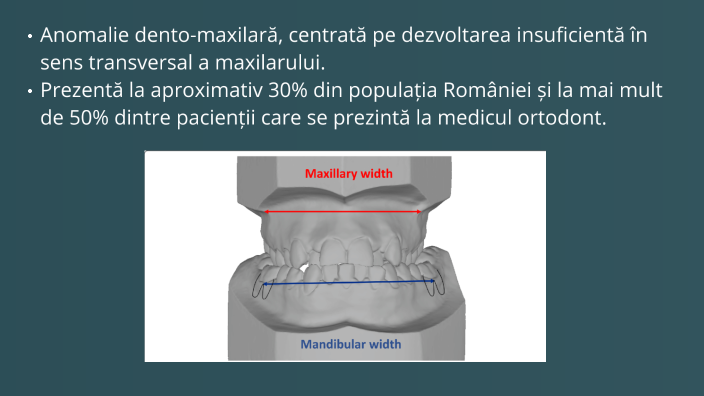 Compresia de maxilar by Anca David on Prezi