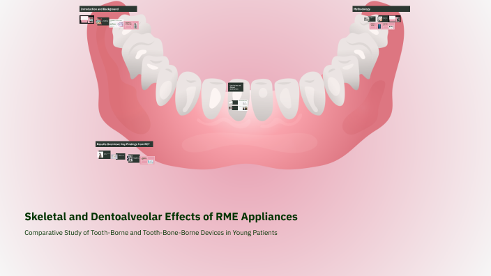 Skeletal and Dentoalveolar Effects of RME Appliances by Neda Sadeghian ...