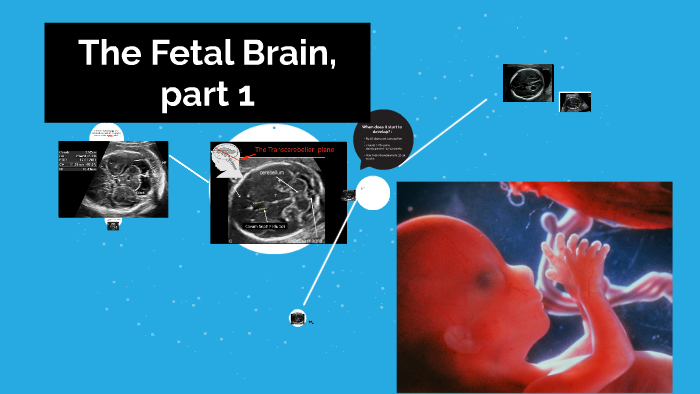 The Fetal Brain by Nicole Lee on Prezi