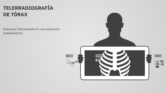 Rx tórax en VPO by Jose Nazario Lopez Taboada on Prezi