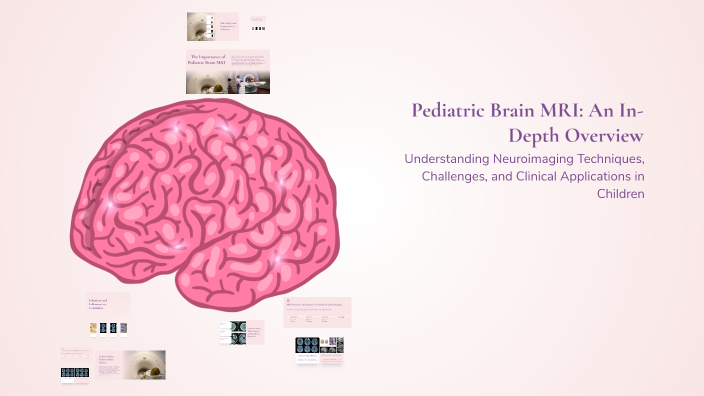 Pediatric Brain MRI: An In-Depth Overview by ftryna on Prezi