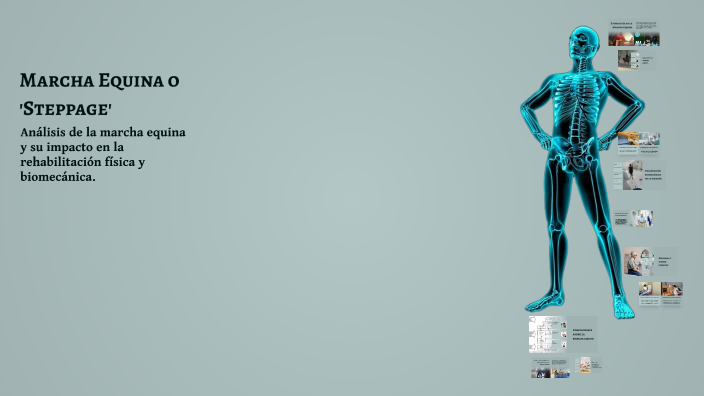 Marcha Equina o 'Steppage' by jack banchon on Prezi