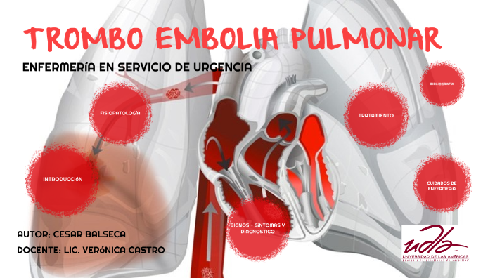 TROMBO EMBOLIA PULMONAR by Cesar Balseca on Prezi