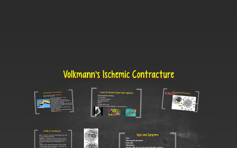 Volkmann's Ischemic Contracture by markee harris