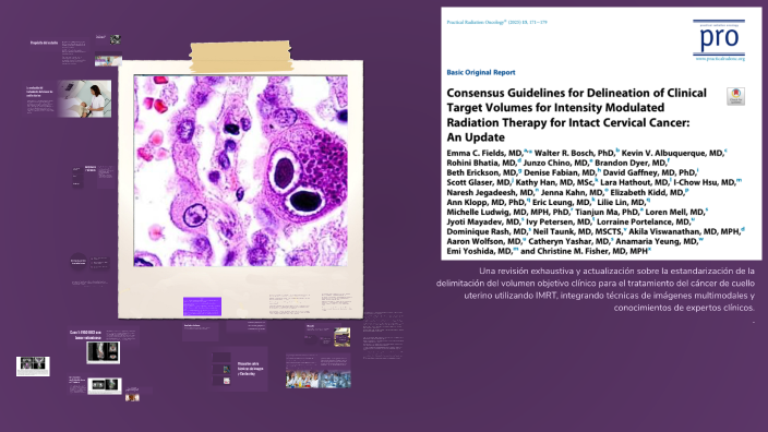 Consensus Guidelines for Clinical Target Volume Delineation in ...