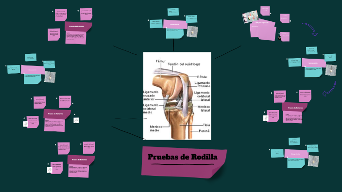 Pruebas de Rodilla by Leidy Cardona on Prezi