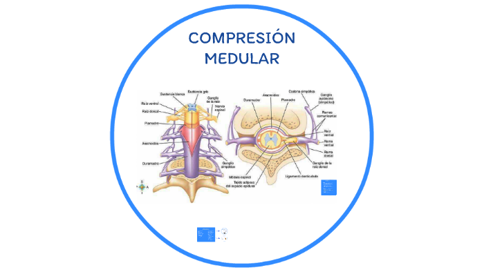 COMPRESIÓN MEDULAR by eme gomez on Prezi