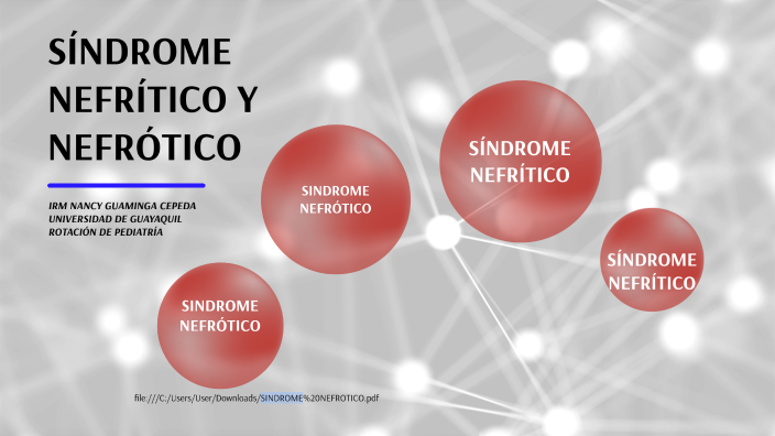 SÍNDROME NEFRÍTICO - NEFRÓTICO by NANCY ANABEL GUAMINGA CEPEDA on Prezi