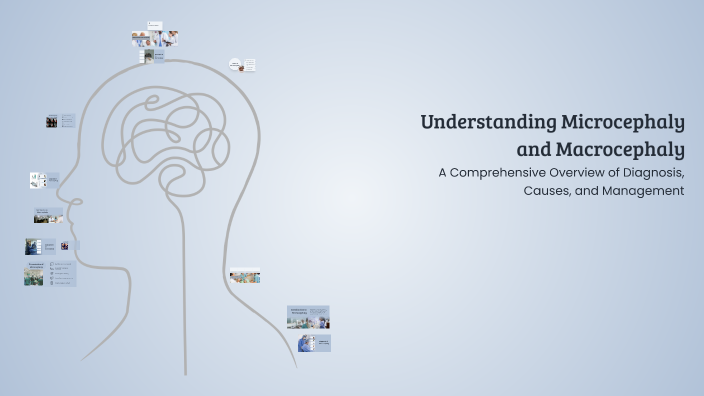Understanding Microcephaly and Macrocephaly by Ahmed Alketbi on Prezi