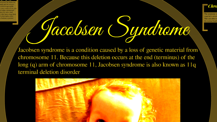 Jacobsen Syndrome by Pete DeLuna Jr