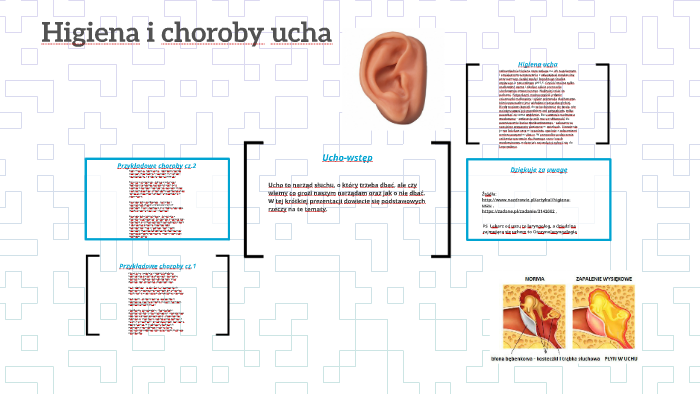 Higiena i choroby ucha by Kamil Krawiec on Prezi