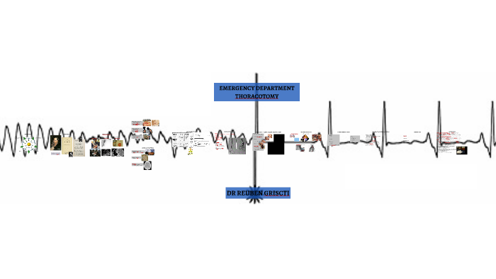 ED Resus Thoracotomy by Reuben Griscti on Prezi